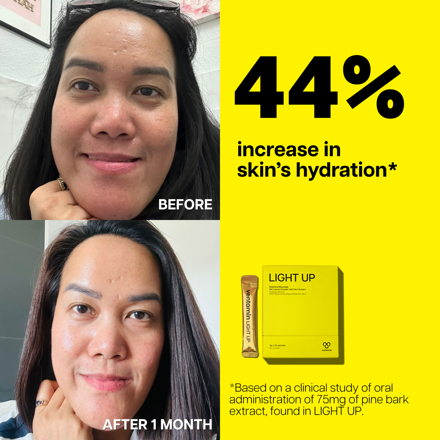 Ventamin Light Up: Illuminate Your Skin with Oral Skincare Solution