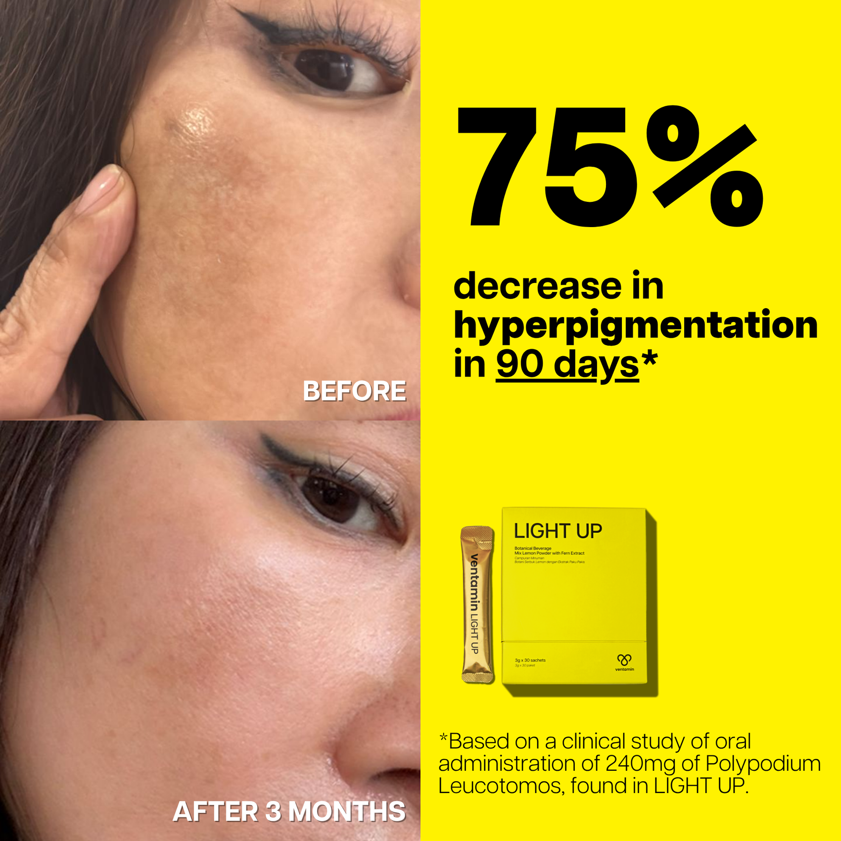 Ventamin Light Up: Illuminate Your Skin with Oral Skincare Solution
